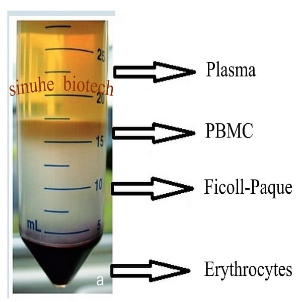 فایکول - Ficoll-Lymphodex Innotrain - زیست فناوری سینوهه - Ficoll